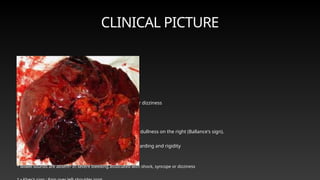 SURGERY.ppt.SPLEEN INJURY HAS MADE EASY IN SLIDES | PPT