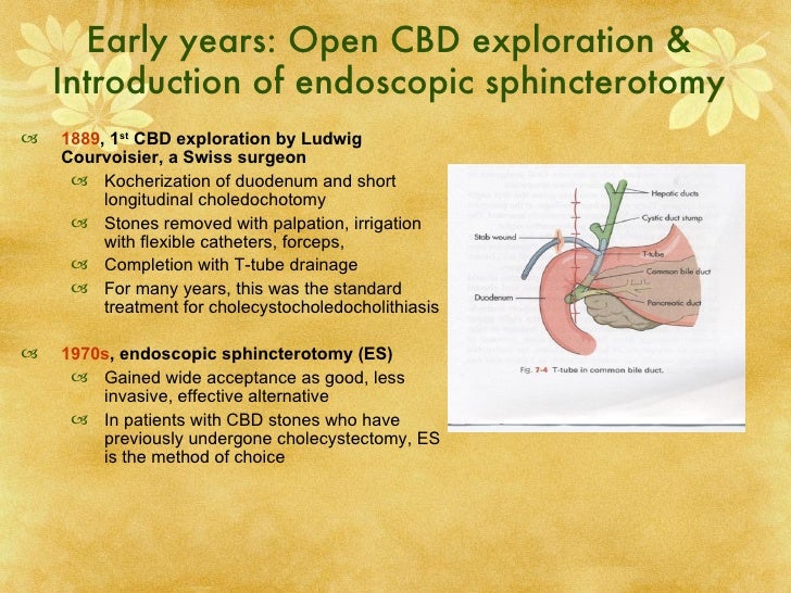 Cholangitis Treatment