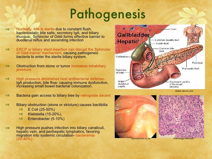 Surgery Cholangitis[1]