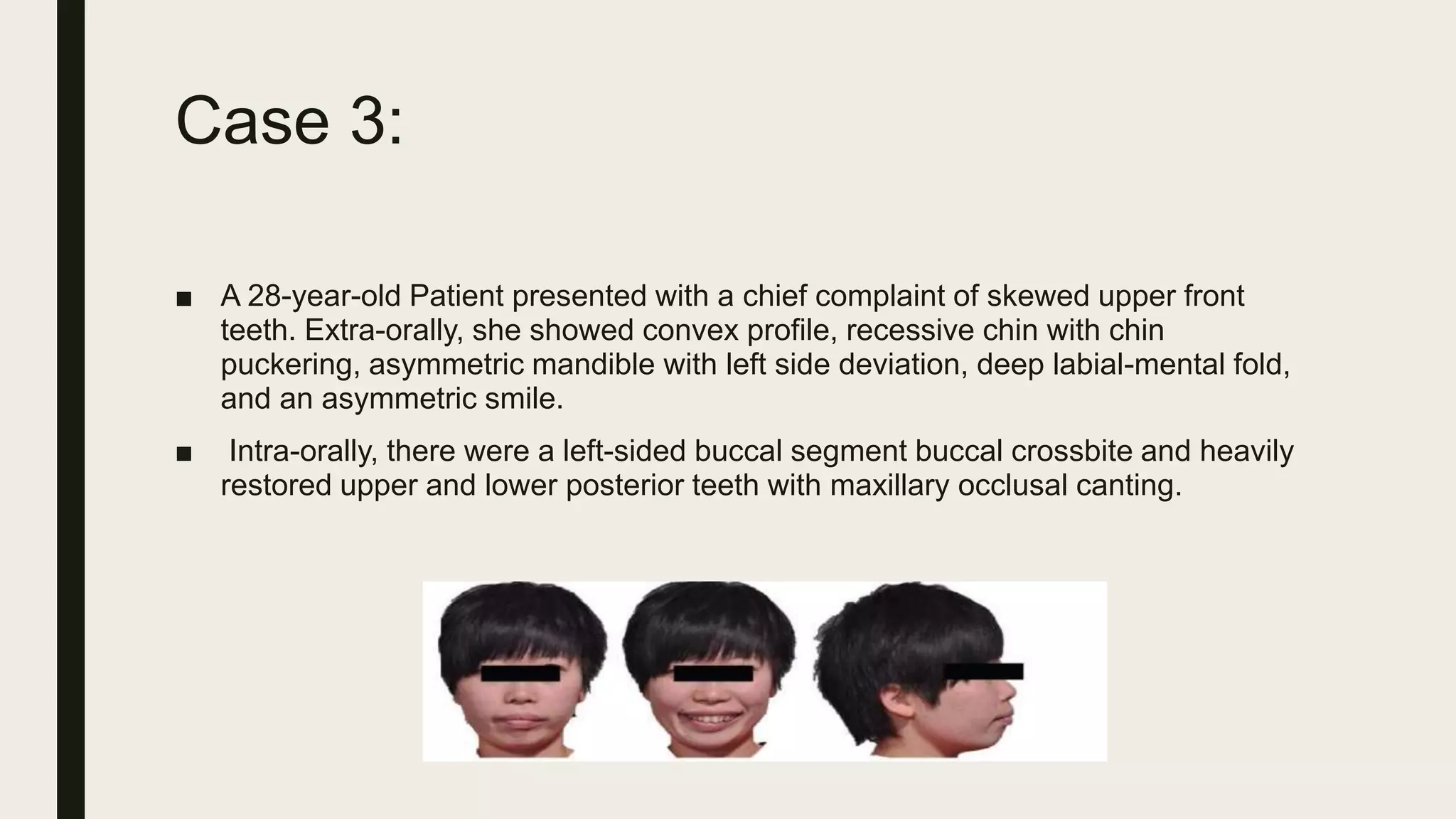 Surgery first orthognathic approach | PPTX