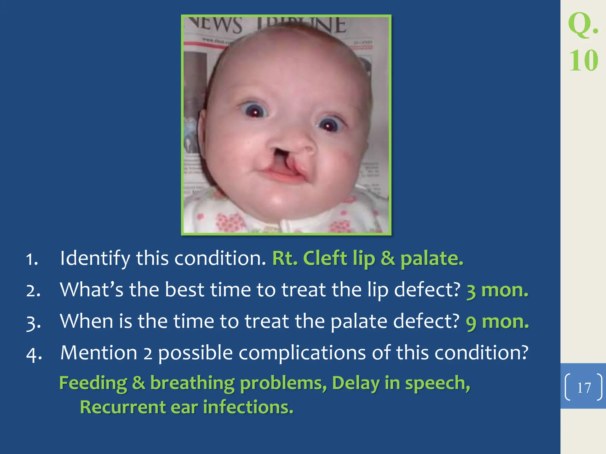 Surgery-Mini-OSCE-All-Past-Years-Questions-Modified. | PDF