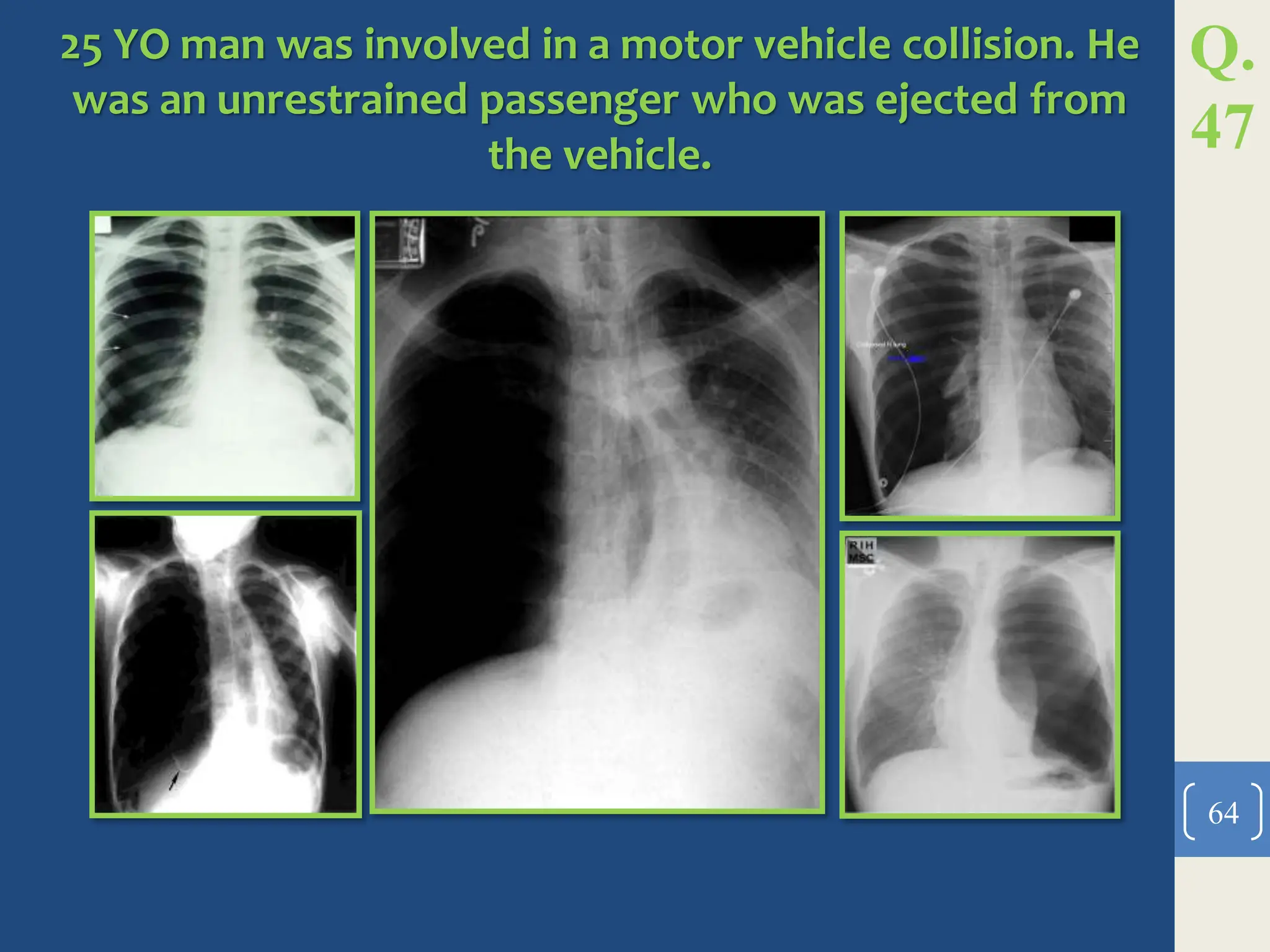 Surgery-Mini-OSCE-All-Past-Years-Questions-Modified. | PDF