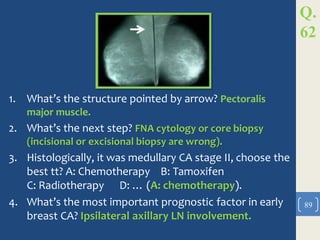 Surgery-Mini-OSCE-All-Past-Years-Questions-Modified. | PDF