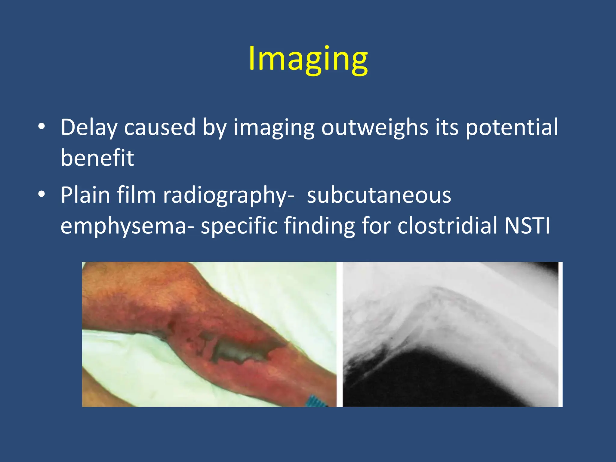 Necrotising soft tissue infection.pptx