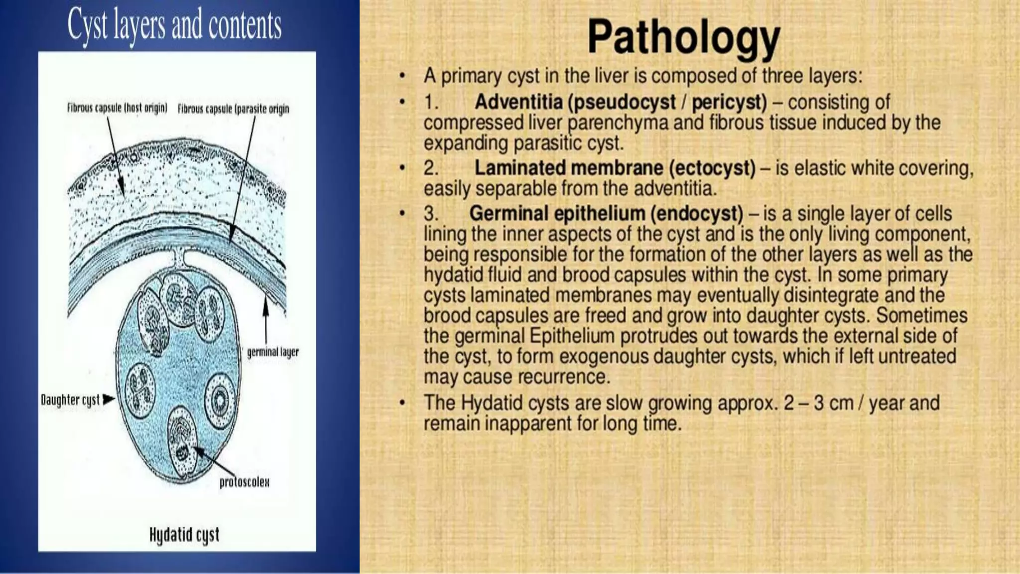 DIFFERENTIAL DIAGNOSIS OF SWELLINGS IN THE RIGHT HYPOCHONDRIUM AND ITS ...