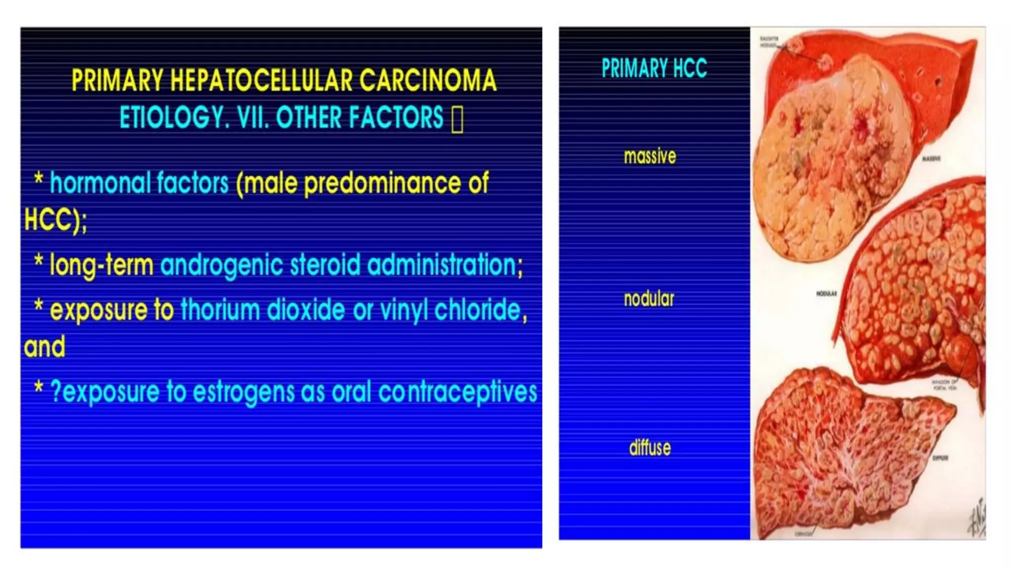 DIFFERENTIAL DIAGNOSIS OF SWELLINGS IN THE RIGHT HYPOCHONDRIUM AND ITS ...