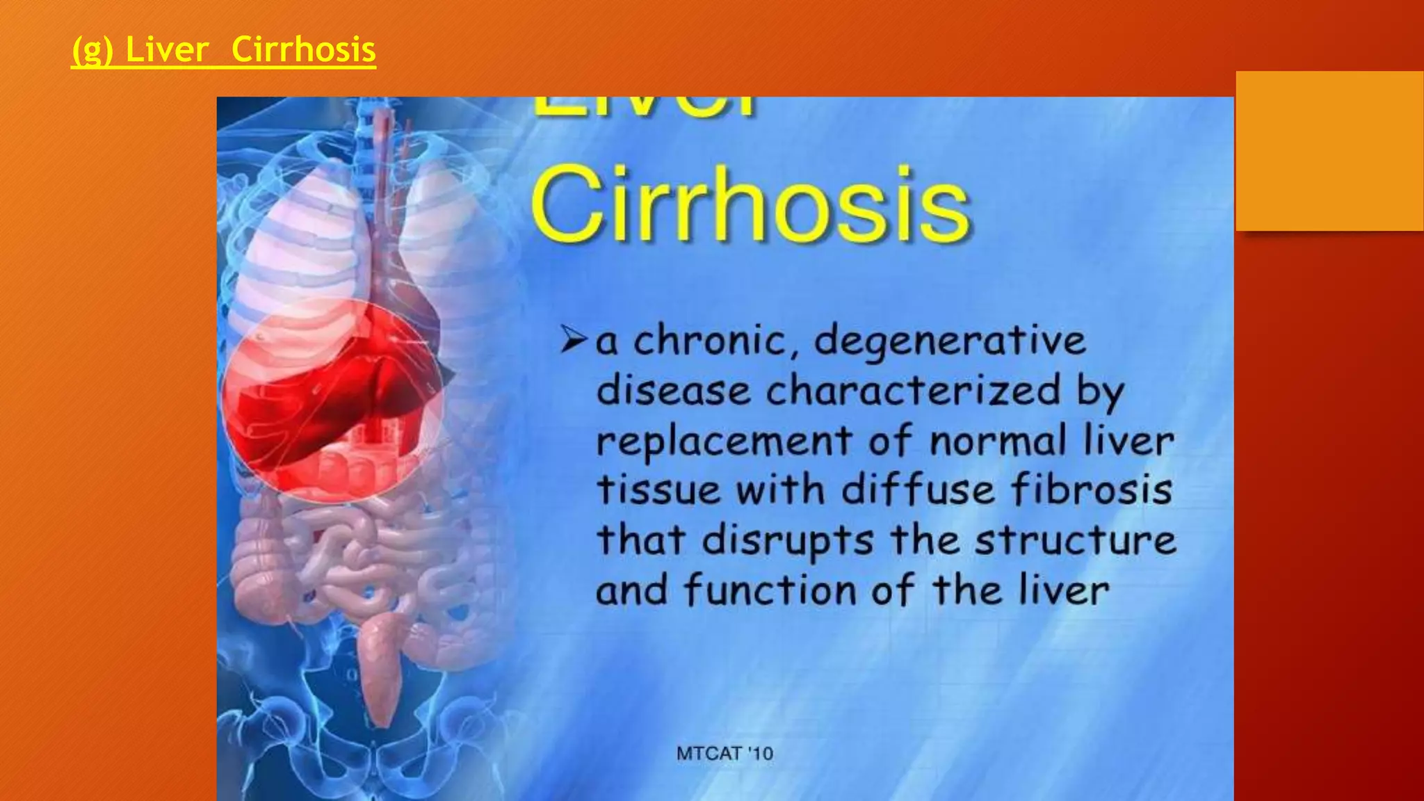 DIFFERENTIAL DIAGNOSIS OF SWELLINGS IN THE RIGHT HYPOCHONDRIUM AND ITS ...
