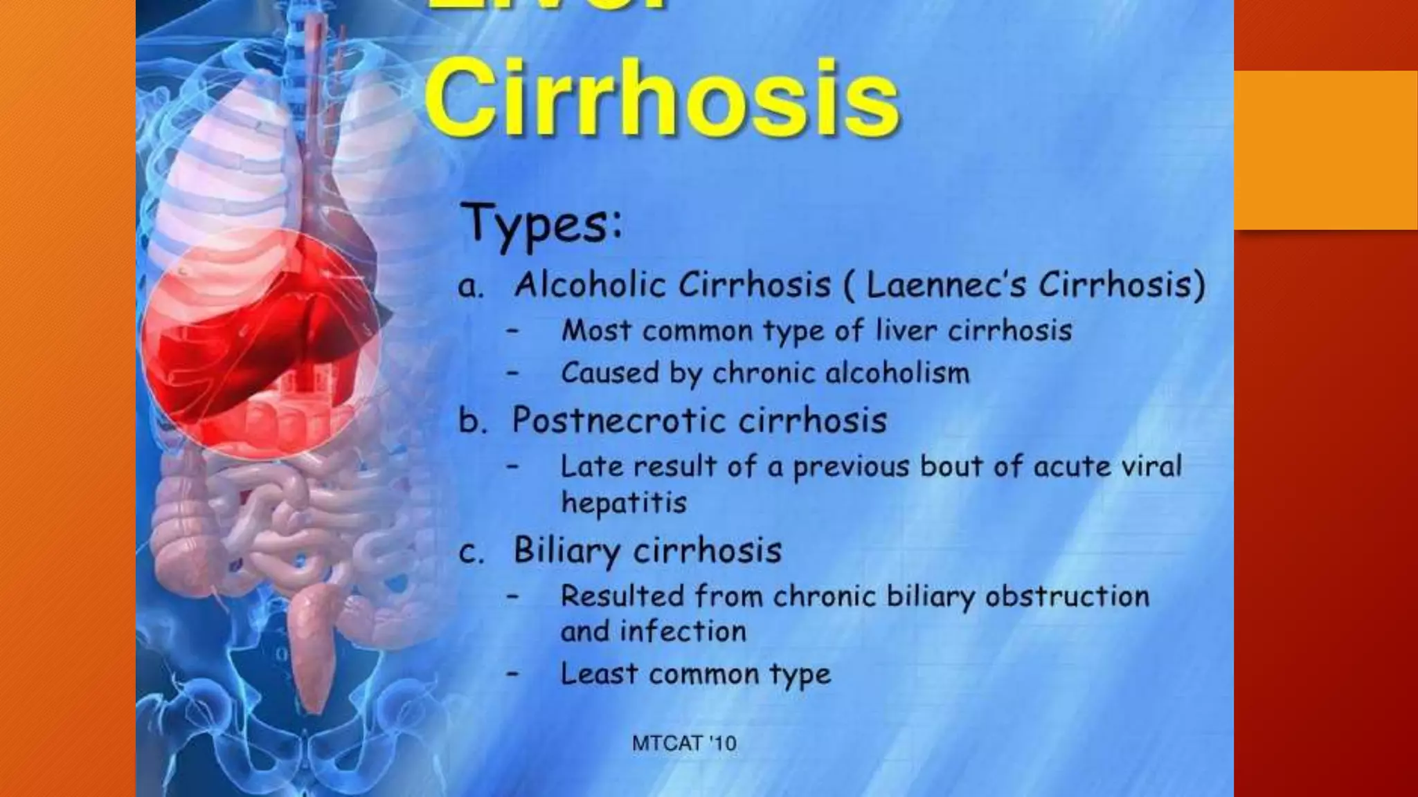 DIFFERENTIAL DIAGNOSIS OF SWELLINGS IN THE RIGHT HYPOCHONDRIUM AND ITS ...