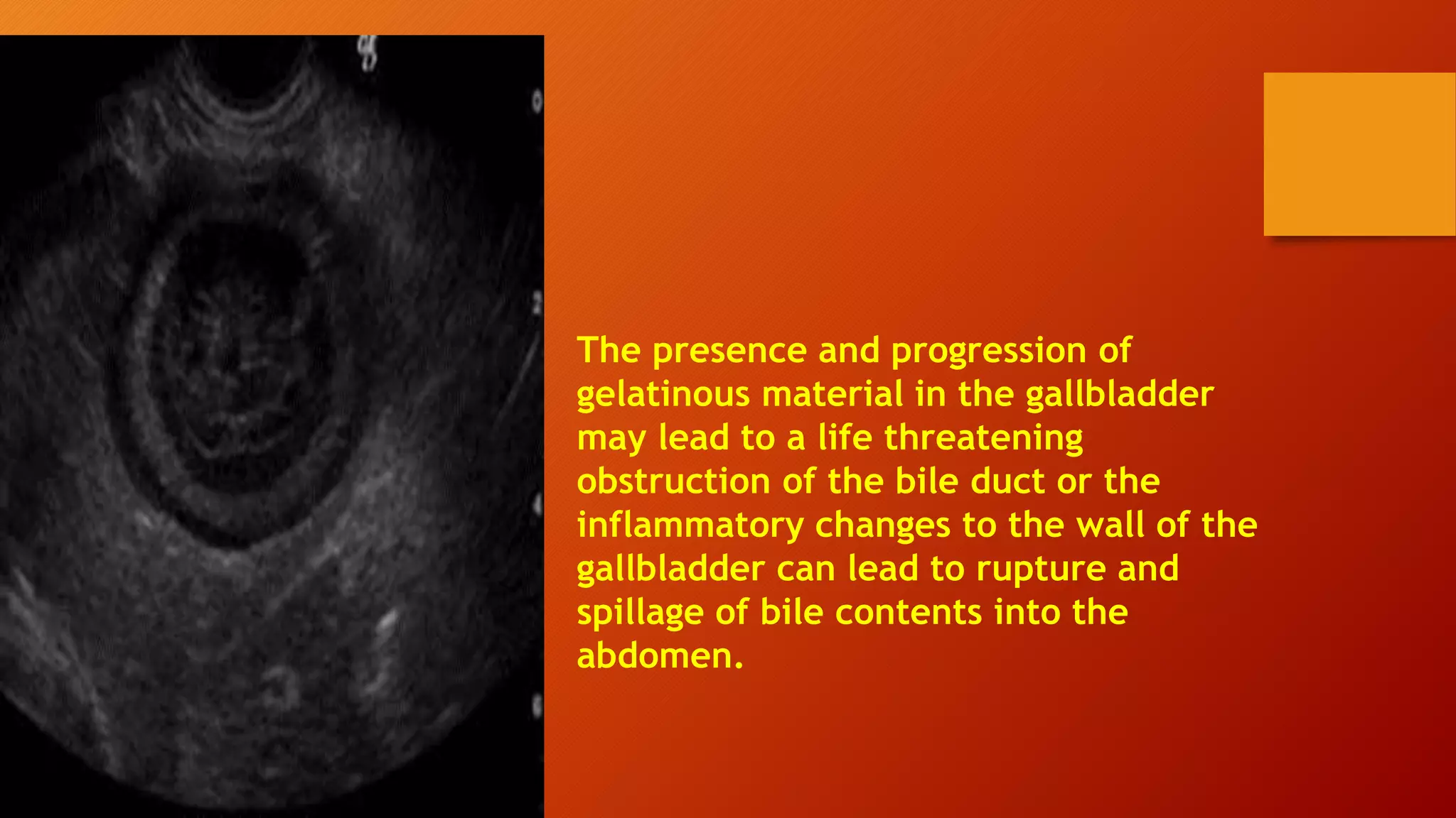 DIFFERENTIAL DIAGNOSIS OF SWELLINGS IN THE RIGHT HYPOCHONDRIUM AND ITS ...