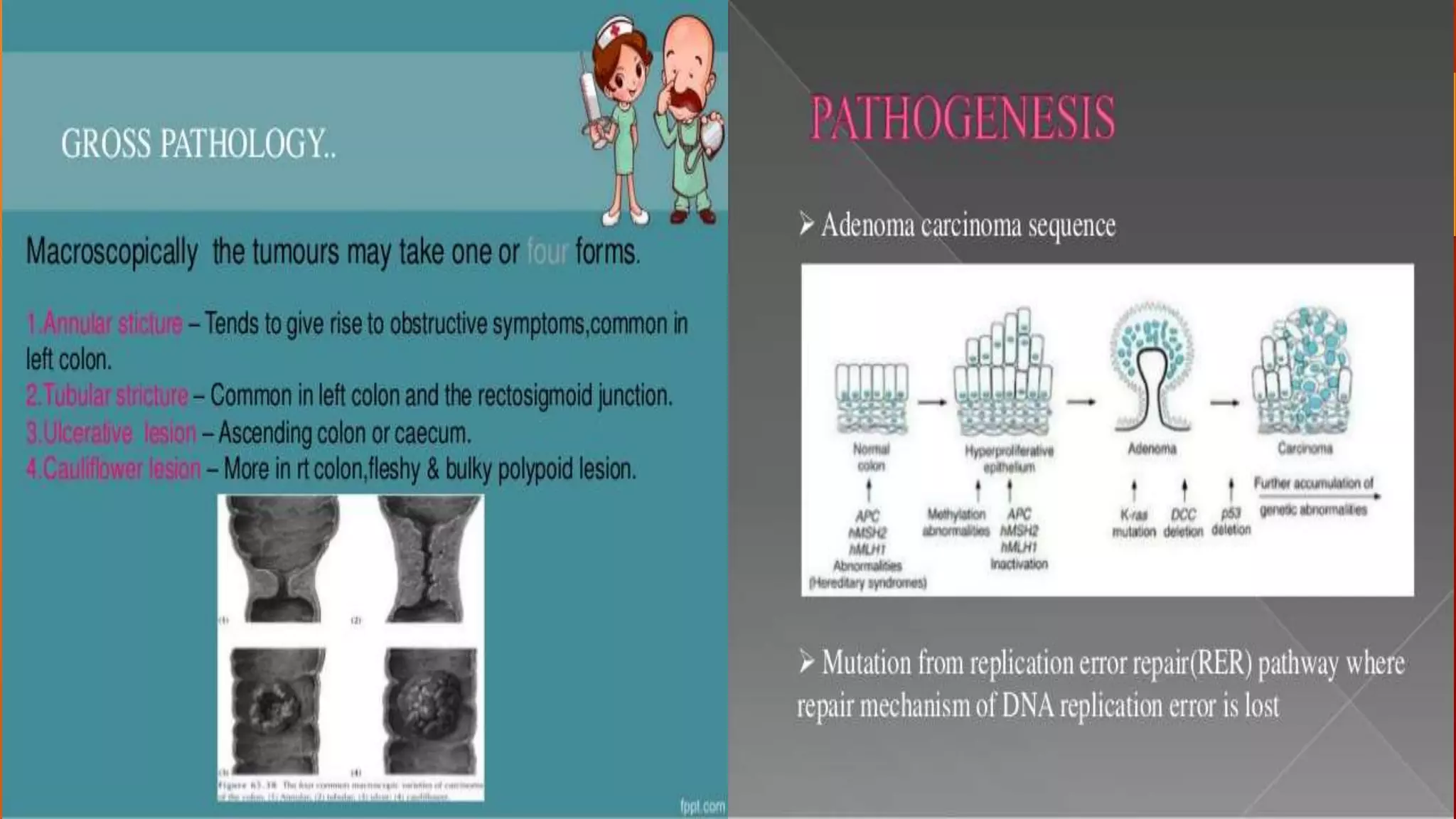 DIFFERENTIAL DIAGNOSIS OF SWELLINGS IN THE RIGHT HYPOCHONDRIUM AND ITS ...
