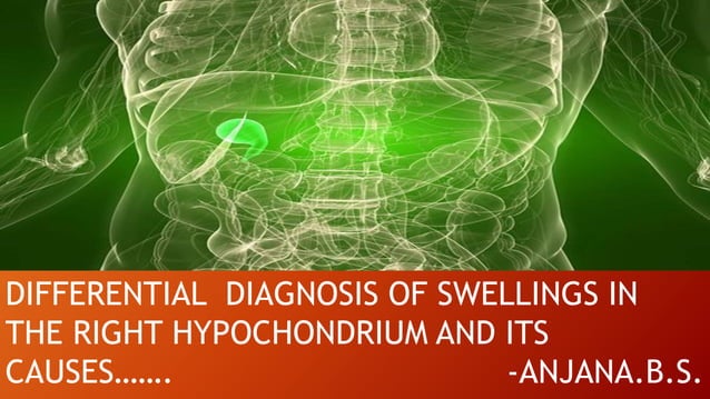DIFFERENTIAL DIAGNOSIS OF SWELLINGS IN THE RIGHT HYPOCHONDRIUM AND ITS ...