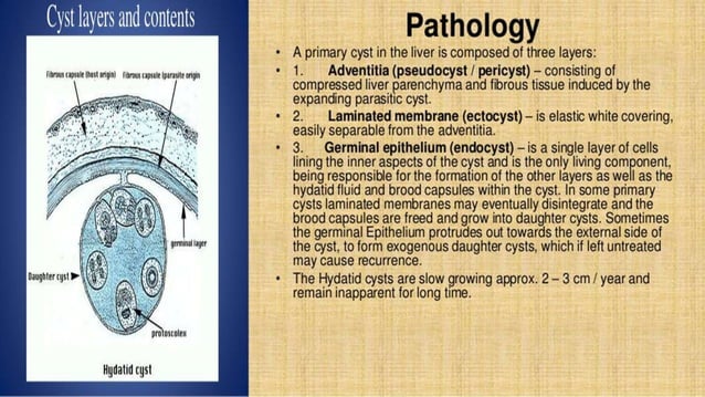 DIFFERENTIAL DIAGNOSIS OF SWELLINGS IN THE RIGHT HYPOCHONDRIUM AND ITS ...