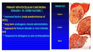 DIFFERENTIAL DIAGNOSIS OF SWELLINGS IN THE RIGHT HYPOCHONDRIUM AND ITS ...