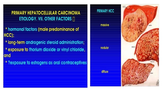 DIFFERENTIAL DIAGNOSIS OF SWELLINGS IN THE RIGHT HYPOCHONDRIUM AND ITS ...