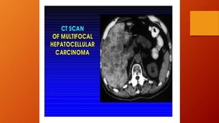 DIFFERENTIAL DIAGNOSIS OF SWELLINGS IN THE RIGHT HYPOCHONDRIUM AND ITS ...