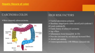 DIFFERENTIAL DIAGNOSIS OF SWELLINGS IN THE RIGHT HYPOCHONDRIUM AND ITS ...