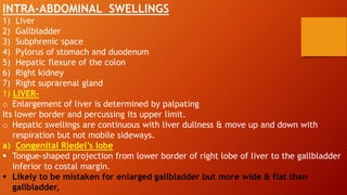 DIFFERENTIAL DIAGNOSIS OF SWELLINGS IN THE RIGHT HYPOCHONDRIUM AND ITS ...