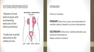 DIFFERENTIAL DIAGNOSIS OF SWELLINGS IN THE RIGHT HYPOCHONDRIUM AND ITS ...
