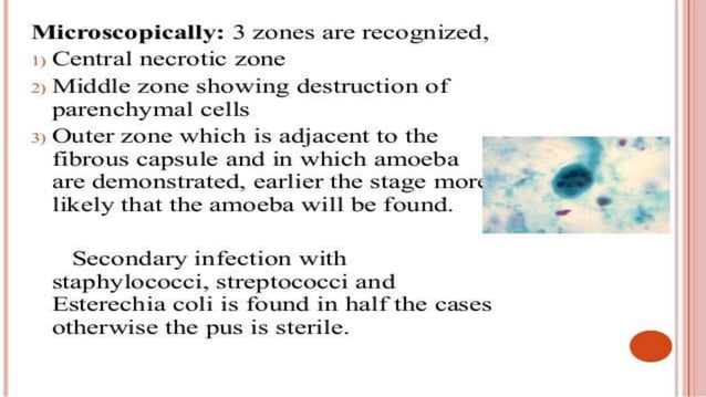 DIFFERENTIAL DIAGNOSIS OF SWELLINGS IN THE RIGHT HYPOCHONDRIUM AND ITS ...