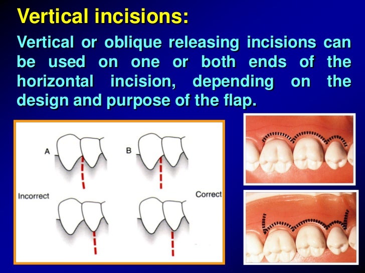 General Principles of Surgical Techniques for Periodontal Regeneration