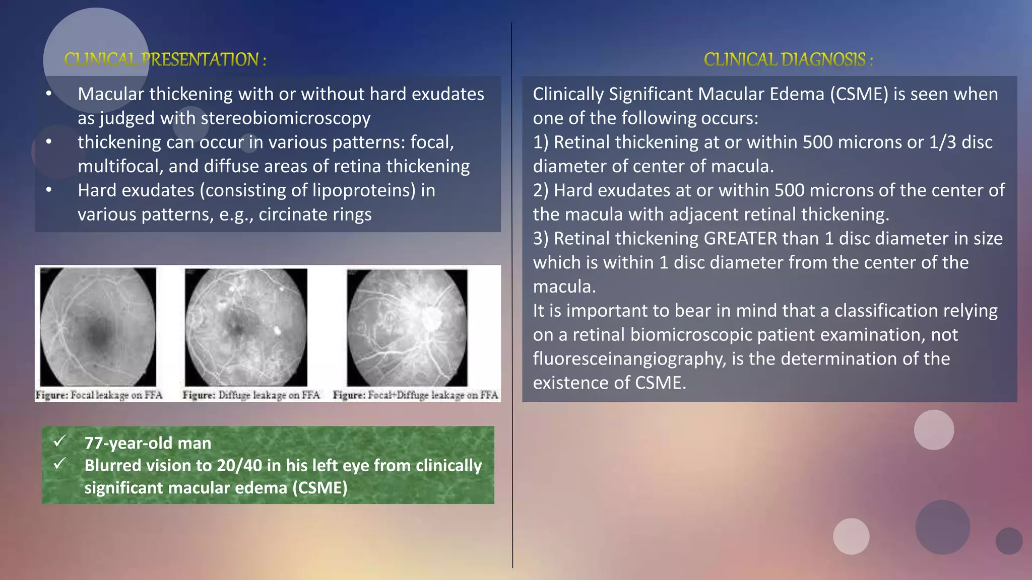 Diabetic Macular Edema (Surgery presentation) | PPTX