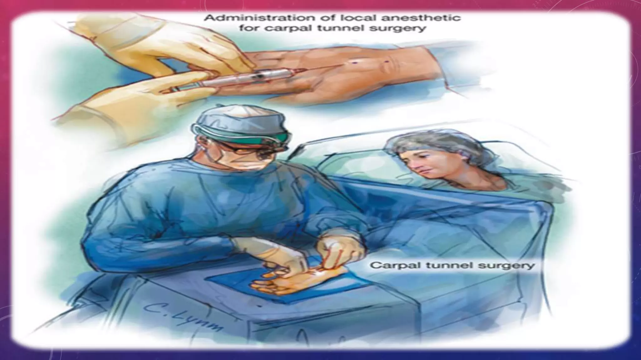 Anesthesia & its types | PPTX