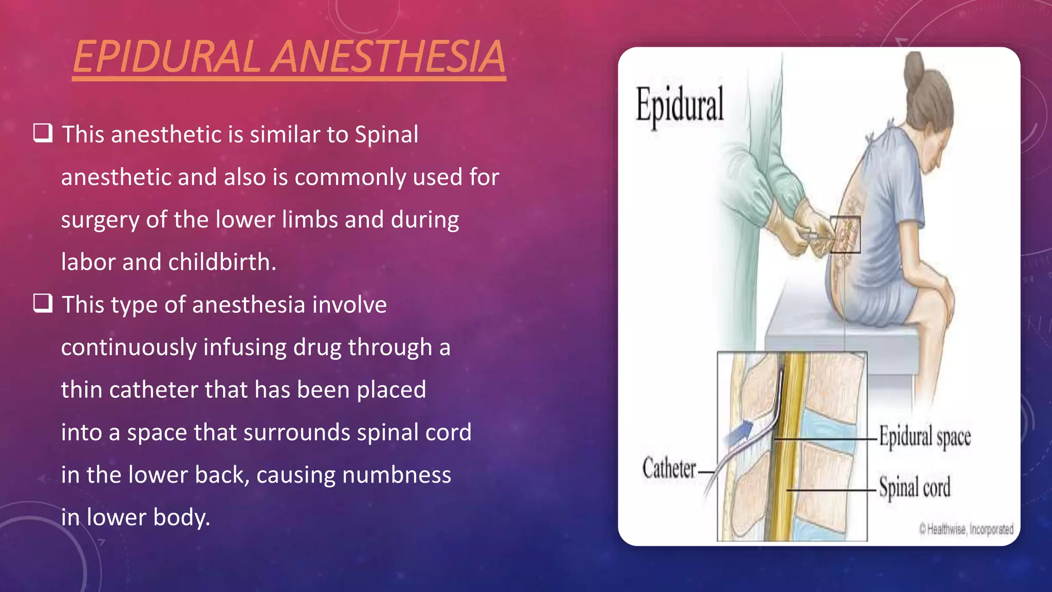 Anesthesia & its types | PPTX