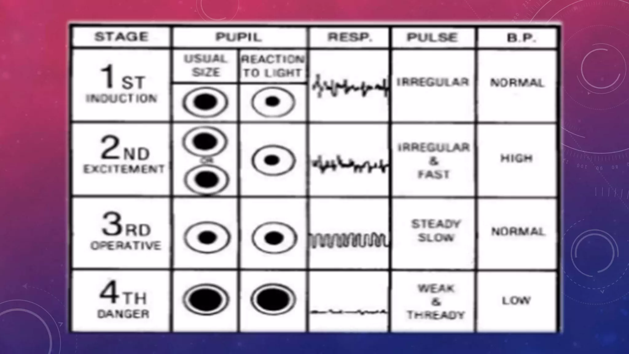Anesthesia & its types | PPTX