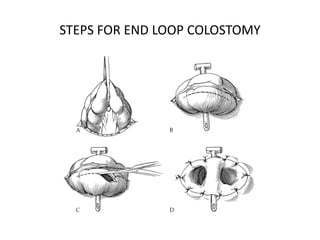 Surgery anorectum colon | PPT