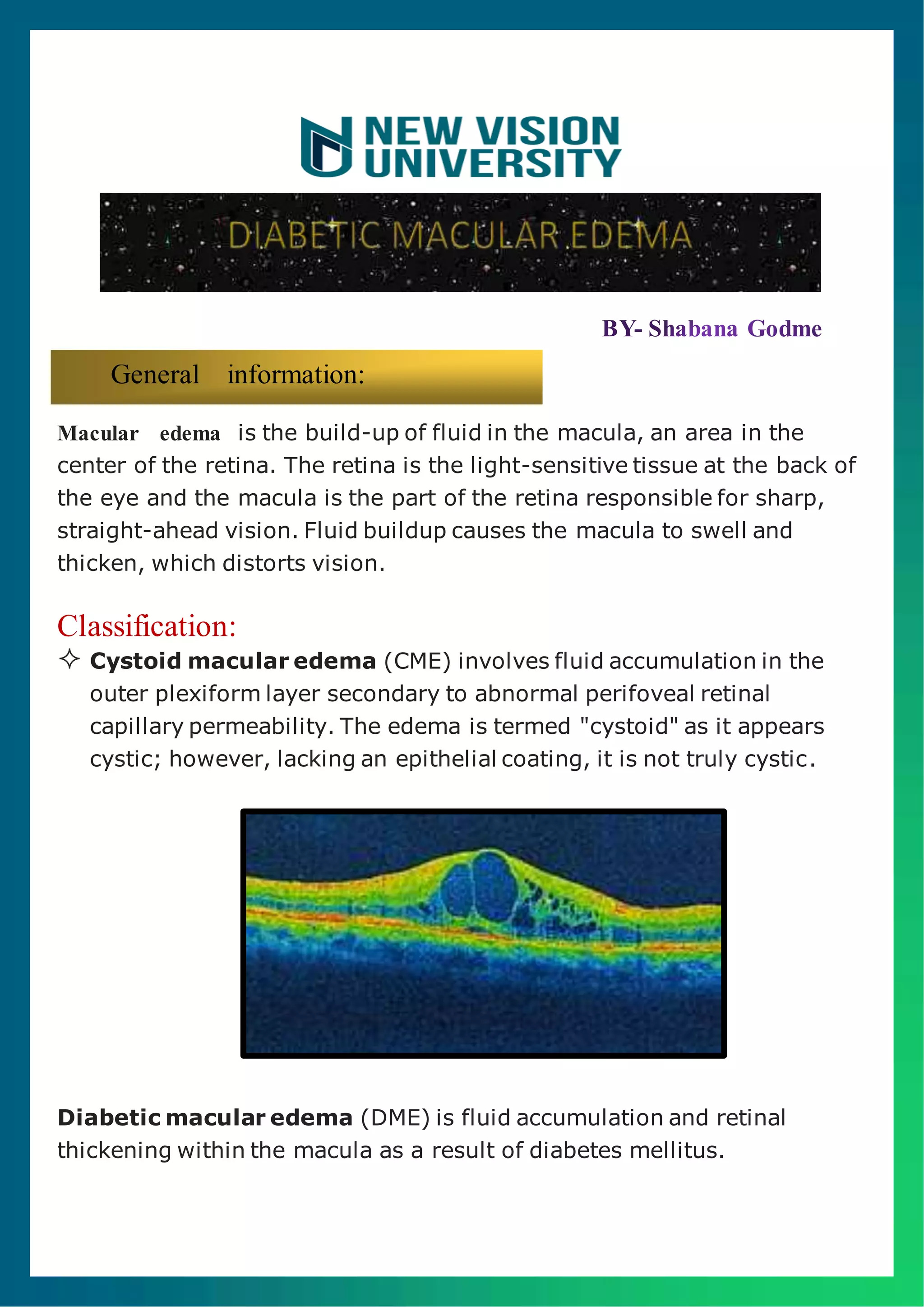 DIABETIC MACULAR EDEMA | DOCX
