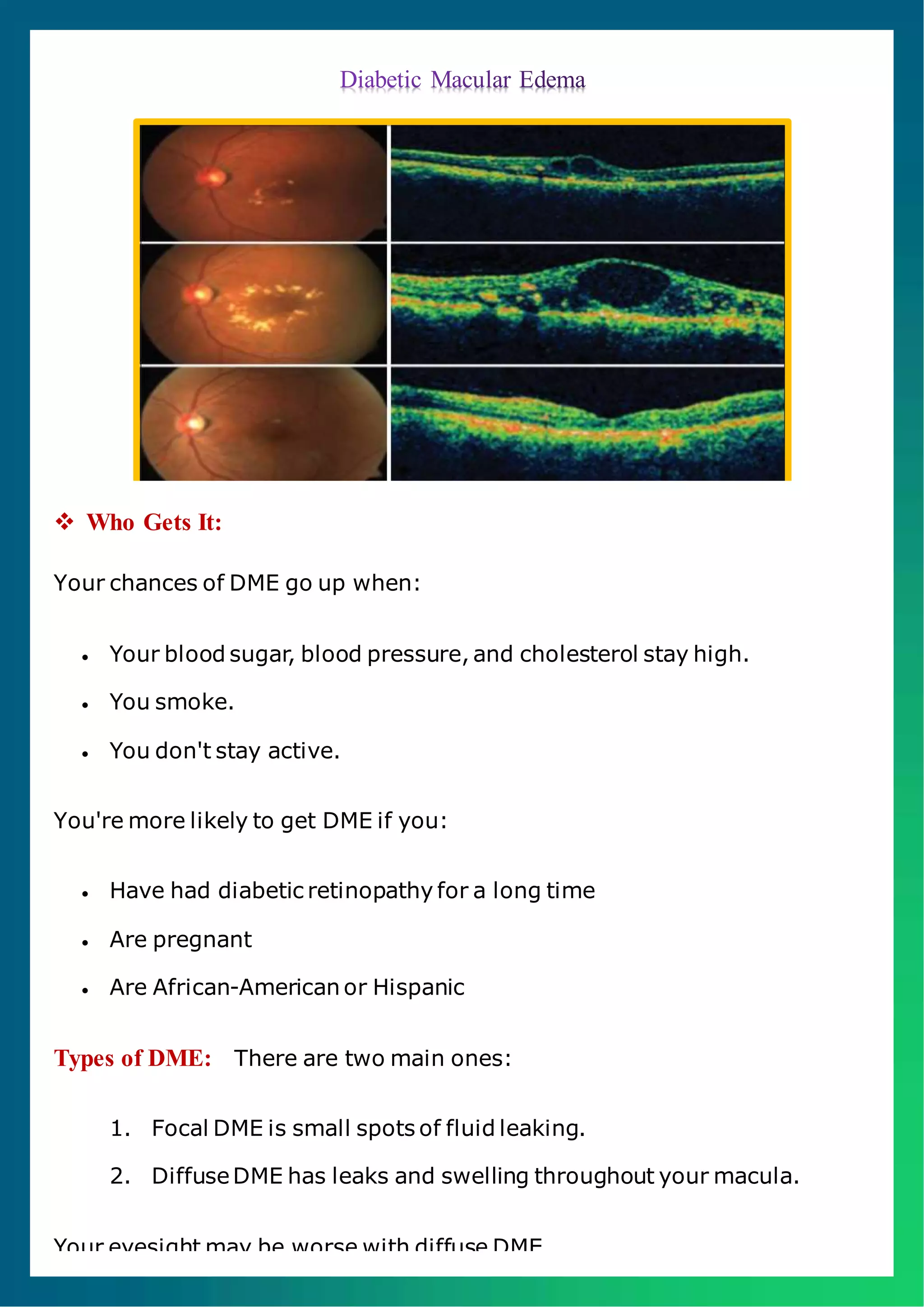 DIABETIC MACULAR EDEMA | DOCX