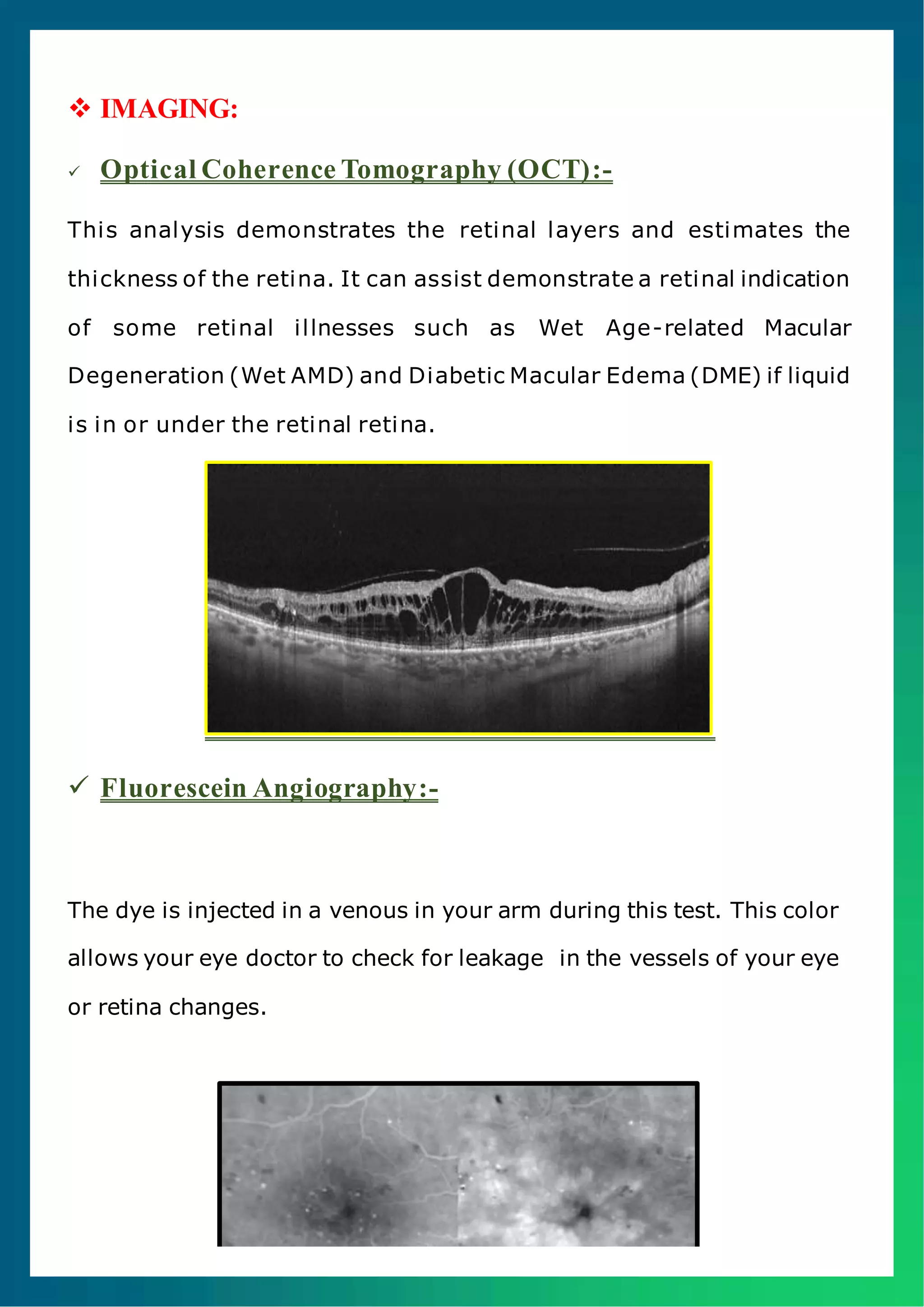 DIABETIC MACULAR EDEMA | DOCX