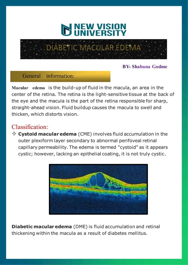 DIABETIC MACULAR EDEMA | DOCX | Eye and Vision Conditions | Diseases ...