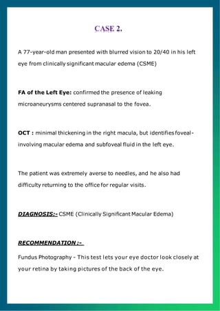 DIABETIC MACULAR EDEMA | DOCX