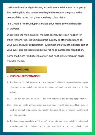 DIABETIC MACULAR EDEMA | DOCX