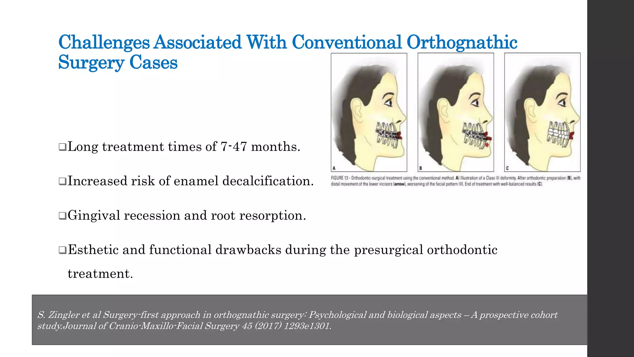 Surgery first orthognathic approach | PPTX