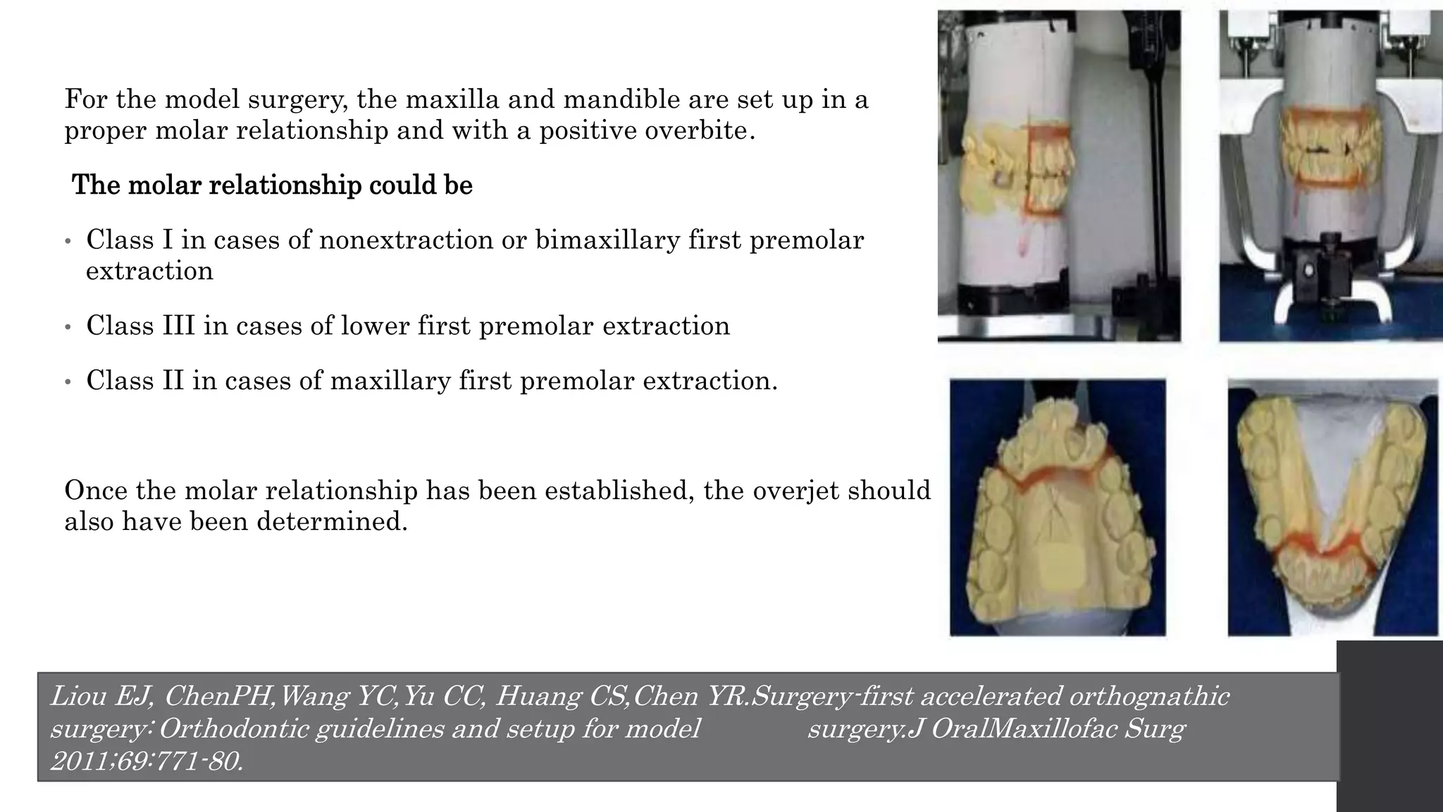 Surgery first orthognathic approach | PPTX
