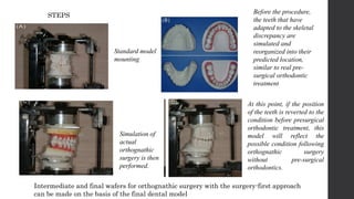 Surgery first orthognathic approach | PPTX
