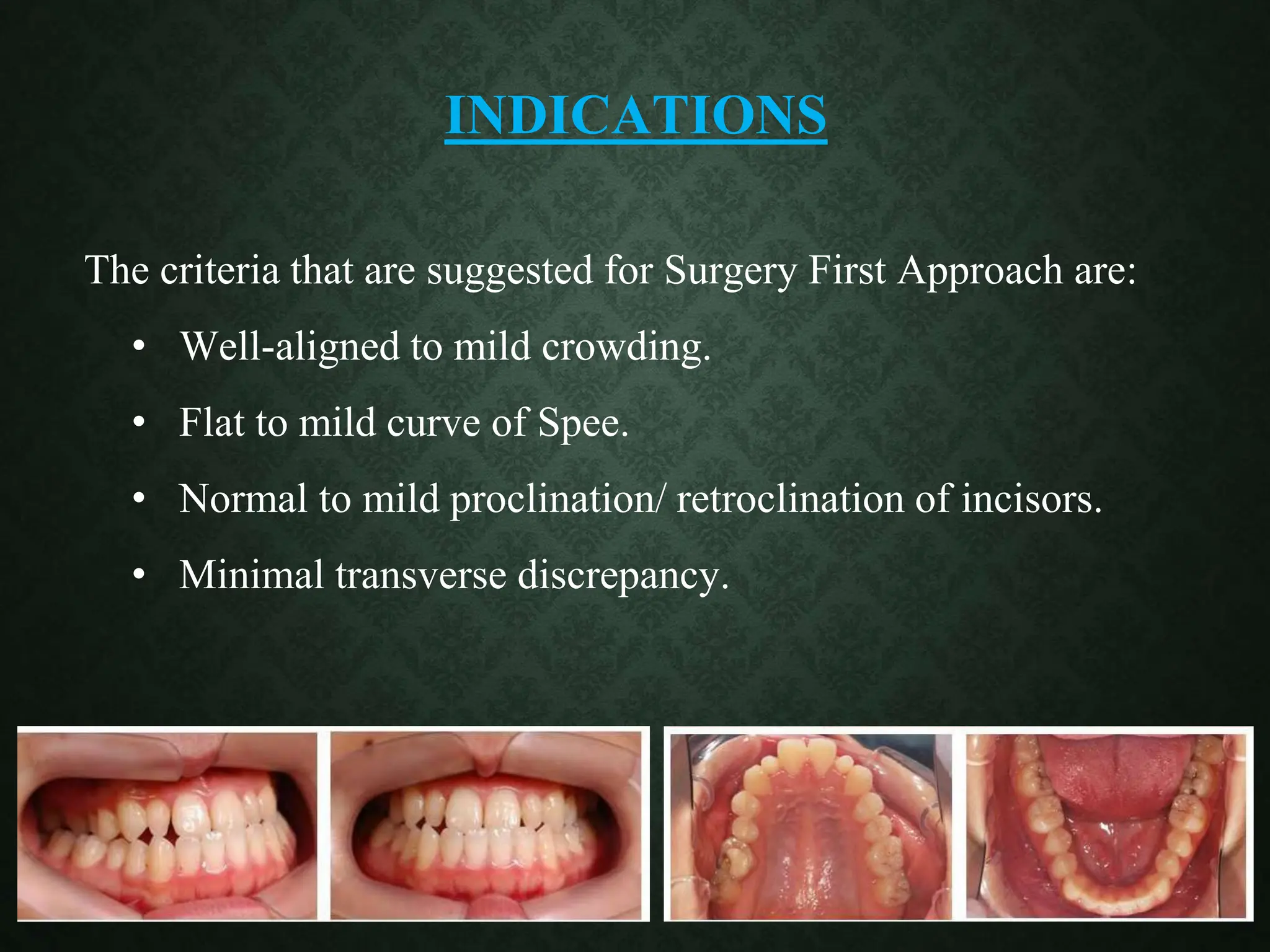 surgery first approach presentation latest | PPTX