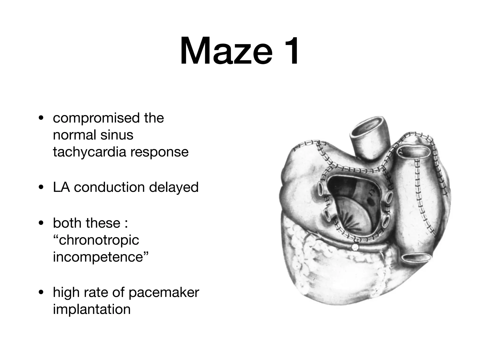 Surgery for atrial fibrillation abhijit presentation | PPT