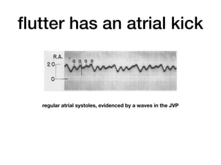 Surgery for atrial fibrillation abhijit presentation | PDF