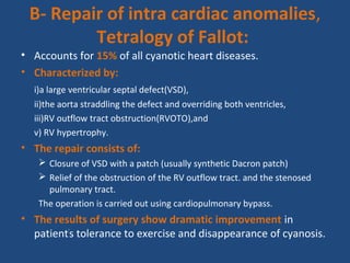 Surgery for Congenital Heart Diseases | PPT