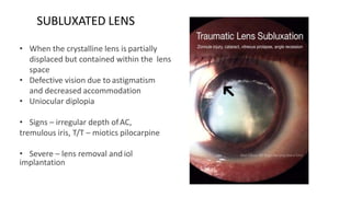 Surgery for ocular trauma | PPTX