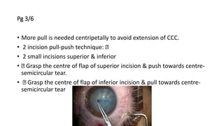 Surgery for pediatric cataracts | PPTX