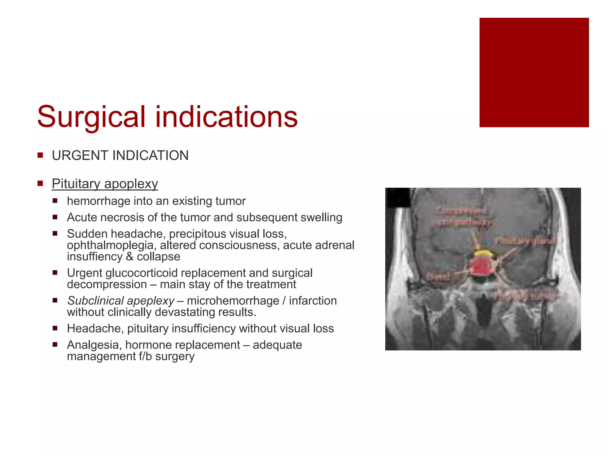 Surgery for pituitary adenomas | PPTX