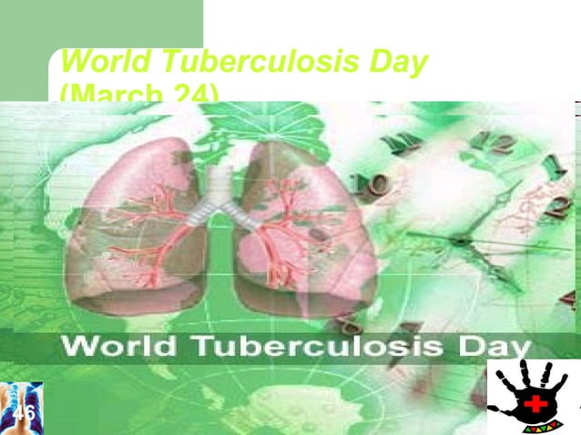 Surgery for pulmonary tuberculosis | PPT | Physical Therapy | Wellness