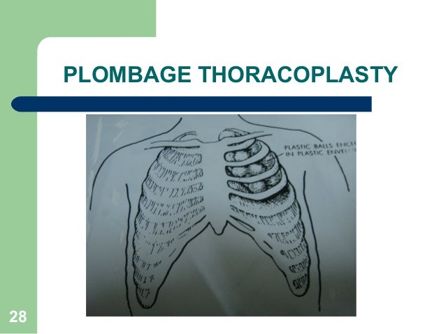 Surgery for pulmonary tuberculosis