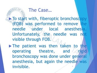 Surgery for Sewing Needle Removal from Left Lower Pulmonary Lobe.pdf