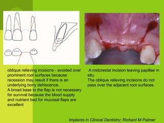 SURGERY FOR TWO STAGE IMPLANT SYSTEM IN ANTERIOR.ppt03.pptx