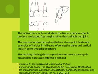 SURGERY FOR TWO STAGE IMPLANT SYSTEM IN ANTERIOR.ppt03.pptx